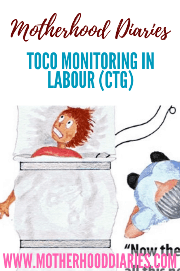 Toco Monitoring in Labour (CTG) - Motherhood Diaries Parenting Magazine ...